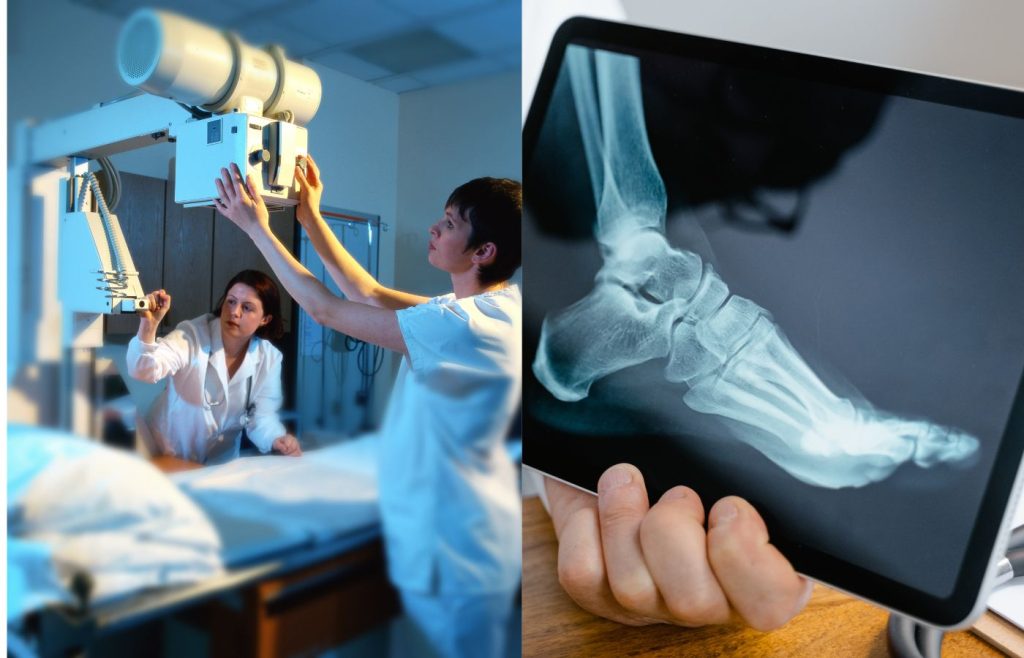 Abdominal X-Rays: When and Why They’re Needed - Vibro Media